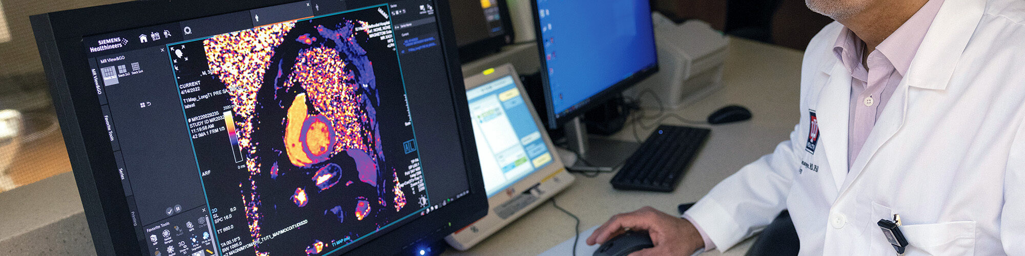 Cardiovascular | IU Health