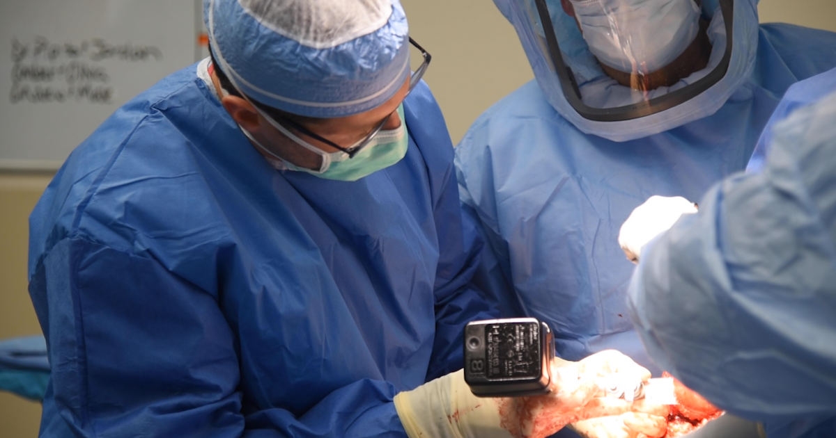 Inside the OR: Reverse total shoulder replacement surgery video | IU Health