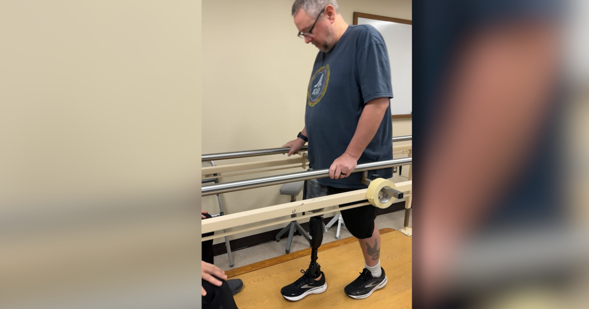 ER nurse in motorcycle crash comes back to work as amputee | IU Health