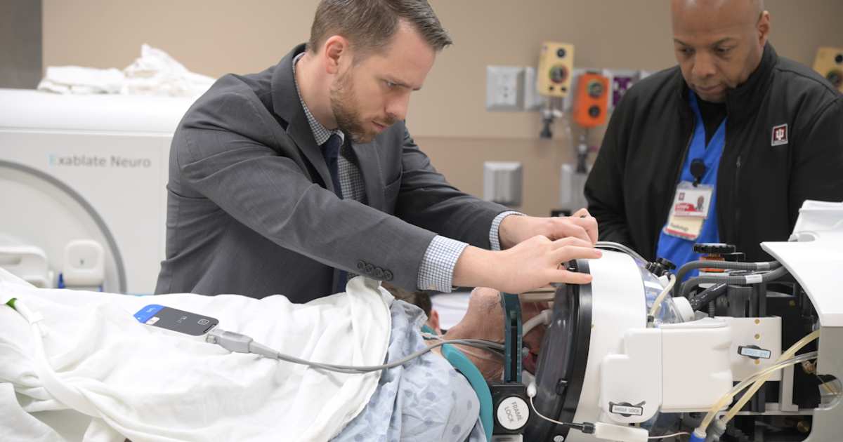 Patients find tremor relief with non invasive focused ultrasound ...