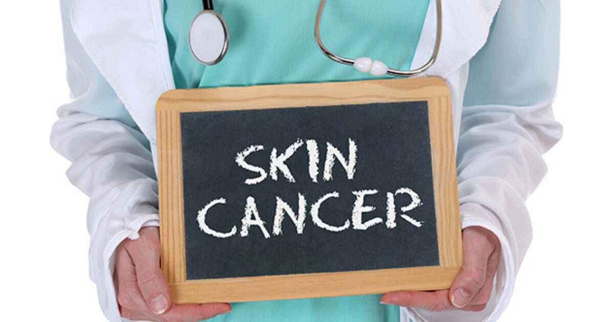 Skin Cancer: 4 Facts You Need to Know | IU Health